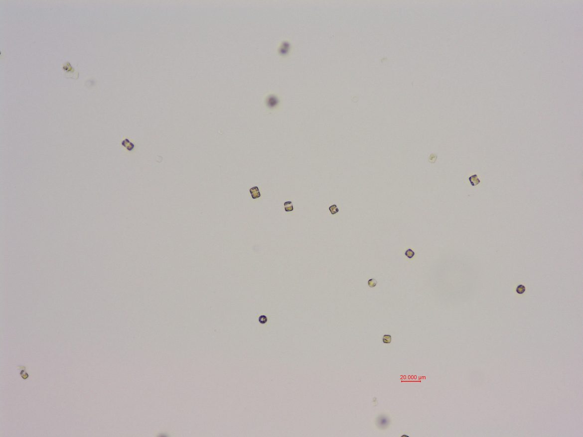 隐秘小环藻 (GY-H67 Cyclotella cryptica) | 上海光语生物科技有限公司